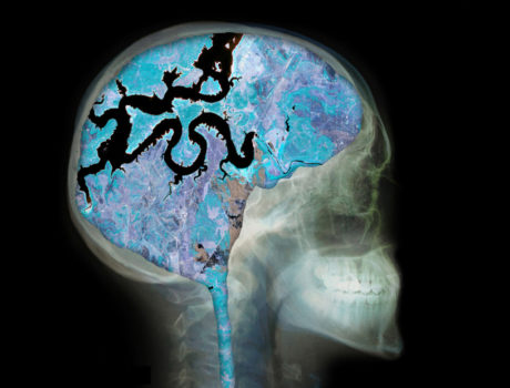 Neurosciences Archives - Med in ArtMed in Art